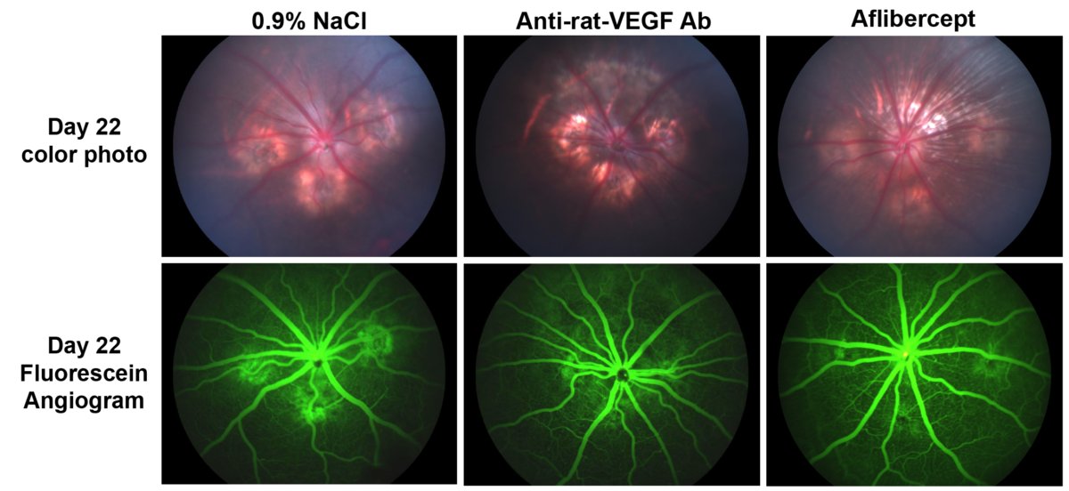 Laser-Induced Choroidal Neovascularization (Laser CNV) - EyeCRO.com